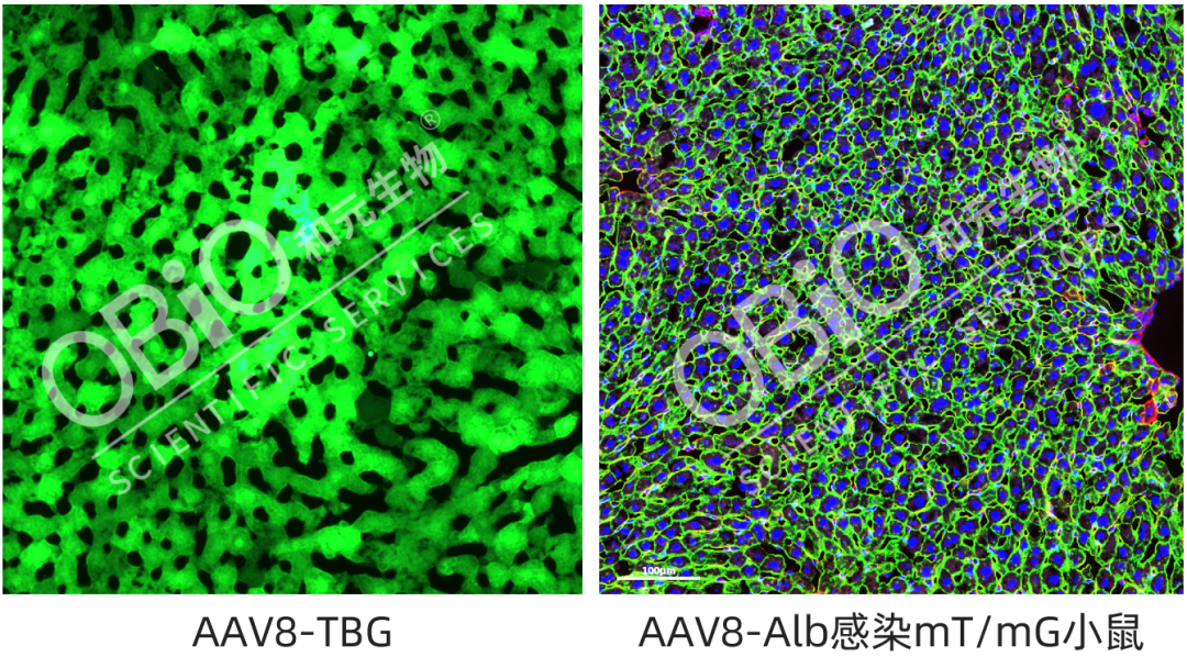 【on-target2.0】AAV感染肝脏 | 血清·启动子·注射技术 | 一篇就GO了医药新闻-ByDrug-一站式医药资源共享中心-医药魔方
