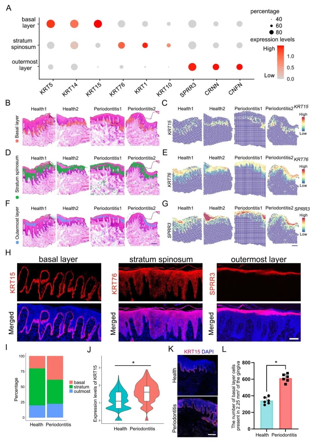 Sci China Life Sci | Stereo-seq与DNBSEQ助力中山大学等研究团队揭示牙周炎的免疫异常机制医药新闻-ByDrug-一站式医药资源共享中心-医药魔方