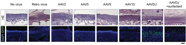 【on-target】AAV感染皮肤 | 血清型·启动子·注射用量 | 一篇就GO了！医药新闻-ByDrug-一站式医药资源共享中心-医药魔方