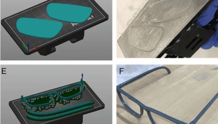 视界前沿：3D打印在眼科领域的进展与应用医药新闻-ByDrug-一站式医药资源共享中心-医药魔方