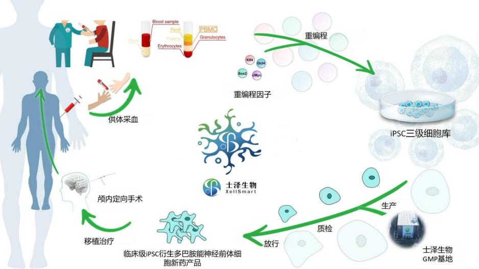 【中美同期批准注册临床试验】通用型iPSC再生细胞治疗帕金森病临床进展突破医药新闻-ByDrug-一站式医药资源共享中心-医药魔方