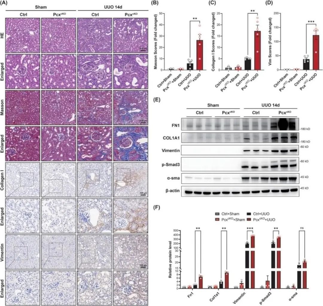 Adv Sci丨揭示PC缺失通过调节SQOR/cGAS/STING介导的糖酵解促进肾脏纤维化进展医药新闻-ByDrug-一站式医药资源共享中心-医药魔方
