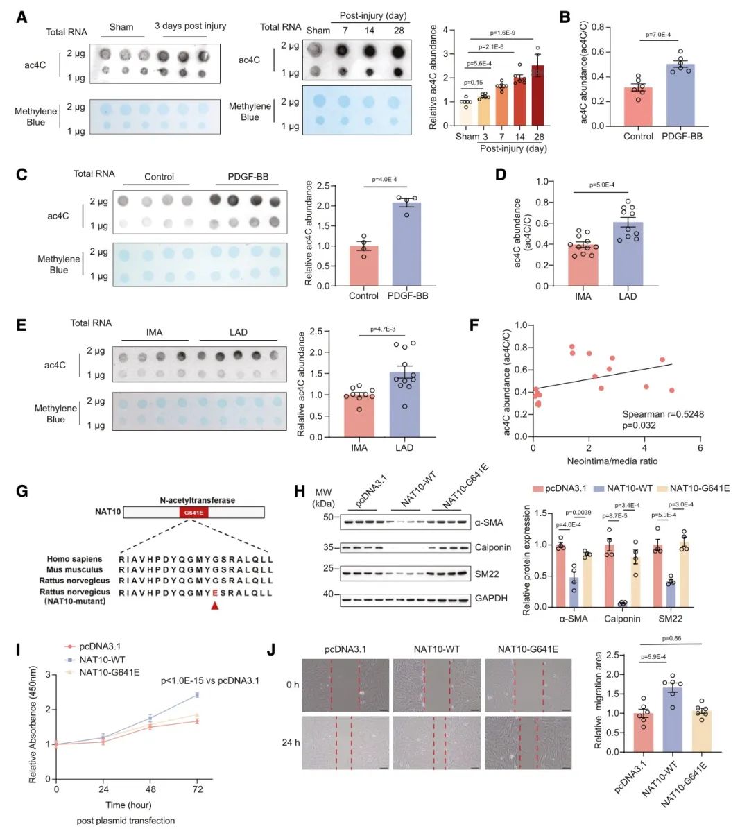EUR HEART J 福建医科大学/陆军军医大学合作发现乙酰化转移酶NAT10通过mRNA ac4C修饰调控血管重构医药新闻-ByDrug-一站式医药资源共享中心-医药魔方