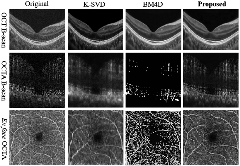 OCT生物标志物研究速览（一）：青光眼医药新闻-ByDrug-一站式医药资源共享中心-医药魔方