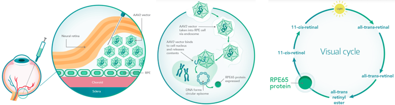 一文梳理│罕见病领域已上市AAV 疗法医药新闻-ByDrug-一站式医药资源共享中心-医药魔方