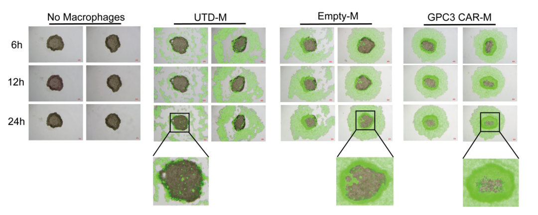 鲲石生物引领创新，全球独家CAR-M平台在肝癌领域再传捷报医药新闻-ByDrug-一站式医药资源共享中心-医药魔方