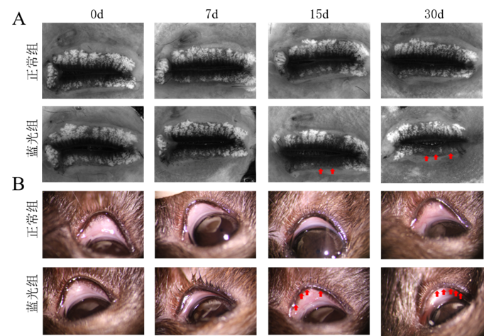 研究前沿｜刘祖国教授解读全氟己基辛烷对蓝光诱导的小鼠MGD模型疗效研究医药新闻-ByDrug-一站式医药资源共享中心-医药魔方