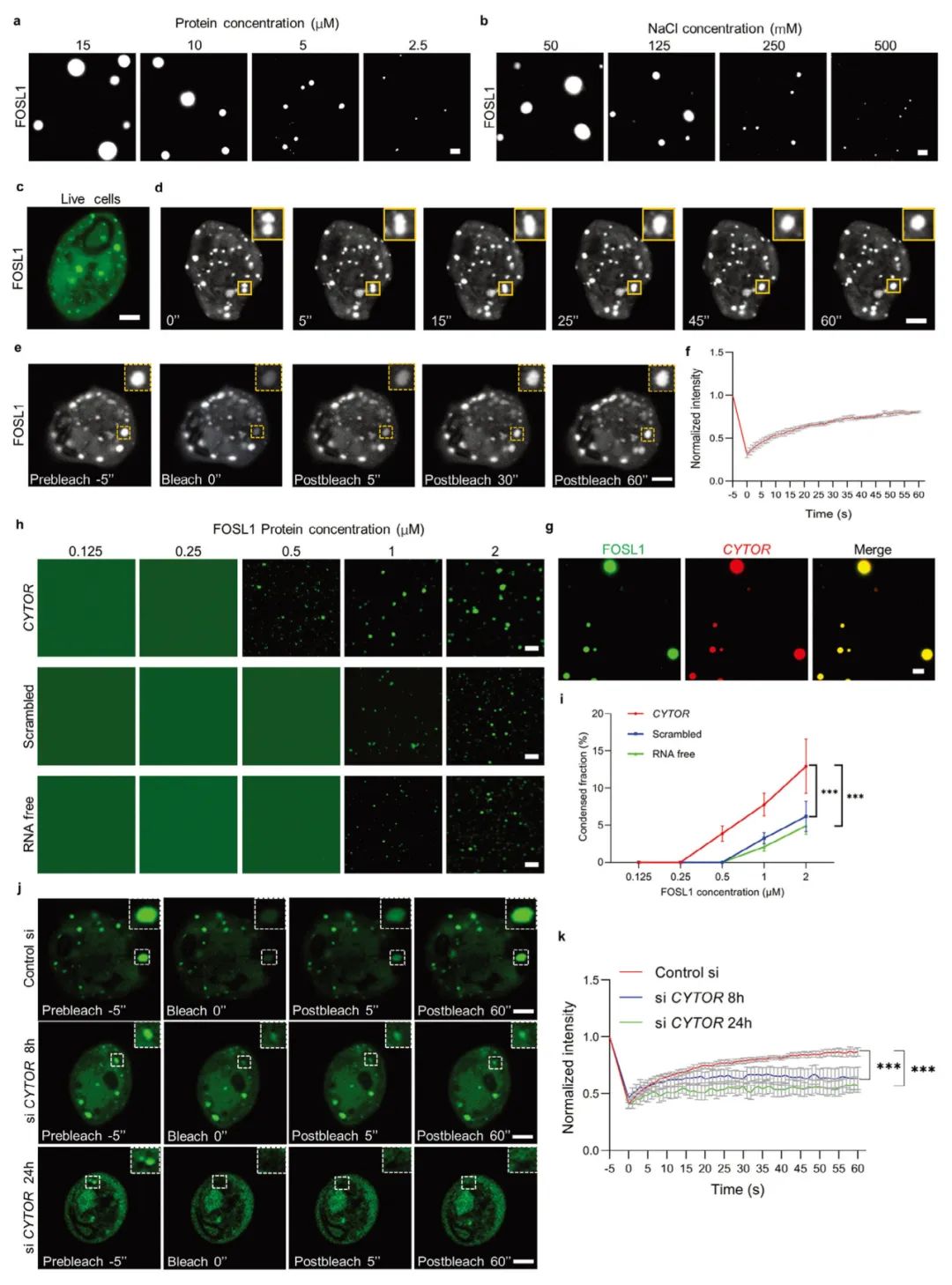 Adv Sci丨光华口腔医院团队揭示超级lncRNA CYTOR驱动HNSCC肿瘤出芽细胞转移的机制医药新闻-ByDrug-一站式医药资源共享中心-医药魔方