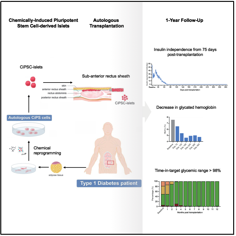 Cell | 首例！我国团队利用移植干细胞制备的胰岛，治愈1型糖尿病患者医药新闻-ByDrug-一站式医药资源共享中心-医药魔方