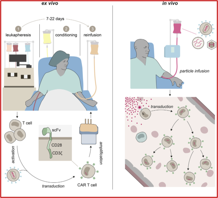 未来已至：慢病毒载体开启in vivo CAR-T细胞治疗新时代医药新闻-ByDrug-一站式医药资源共享中心-医药魔方