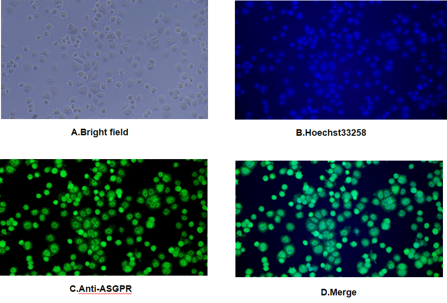 ASGPR：GaINAc-siRNA药物实现肝内靶向递送的关键靶点医药新闻-ByDrug-一站式医药资源共享中心-医药魔方