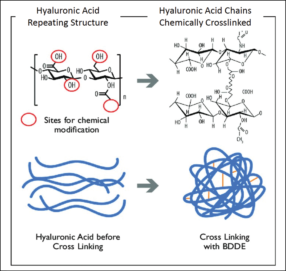 LACRIFILL® 泪小管凝胶：干眼症治疗的范式转变医药新闻-ByDrug-一站式医药资源共享中心-医药魔方