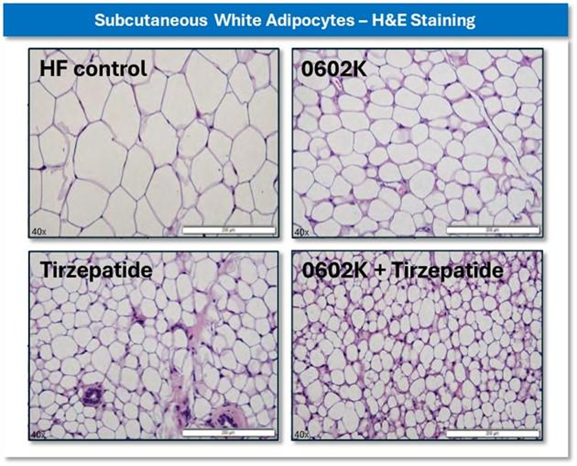 减重新靶点风暴 | ADA 2025医药新闻-ByDrug-一站式医药资源共享中心-医药魔方