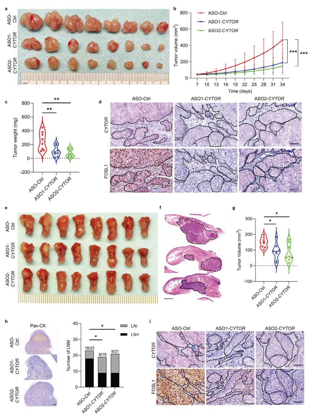 Adv Sci丨光华口腔医院团队揭示超级lncRNA CYTOR驱动HNSCC肿瘤出芽细胞转移的机制医药新闻-ByDrug-一站式医药资源共享中心-医药魔方