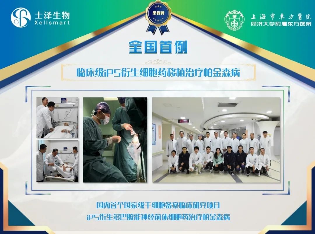 【中国首例】士泽生物成功实施临床级iPS衍生细胞移植治疗帕金森病首例给药医药新闻-ByDrug-一站式医药资源共享中心-医药魔方