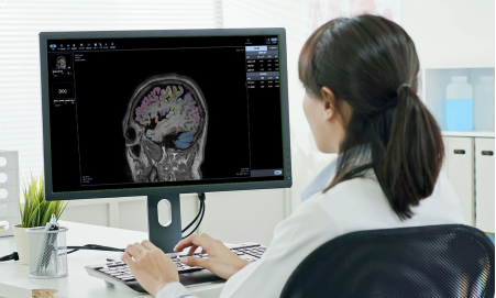 【参股公司医未医疗】获批AI卒中NMPA三类证丨中国唯一在AD及卒中领域均获三类证的企业医药新闻-ByDrug-一站式医药资源共享中心-医药魔方