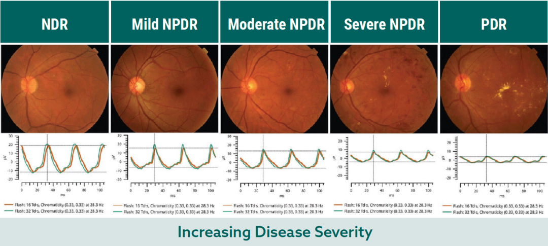 从结构到功能：ERG在DR中的临床应用医药新闻-ByDrug-一站式医药资源共享中心-医药魔方