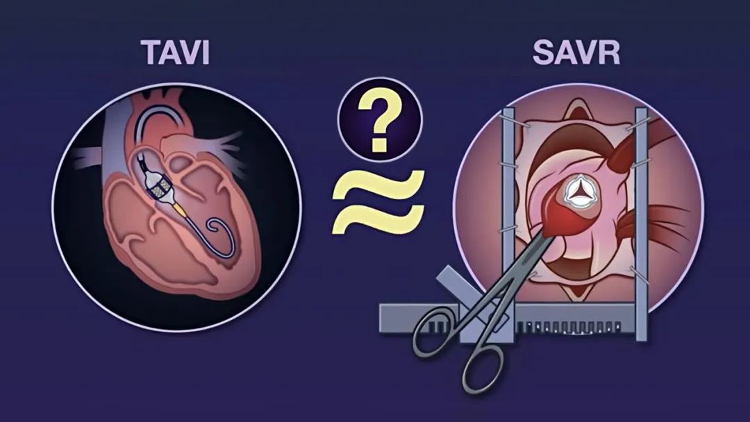 比邻星企业新闻 ｜ 全球首个！TAVR vs. SAVR治疗中高危主动脉瓣反流对照研究入组接近尾声医药新闻-ByDrug-一站式医药资源共享 ...