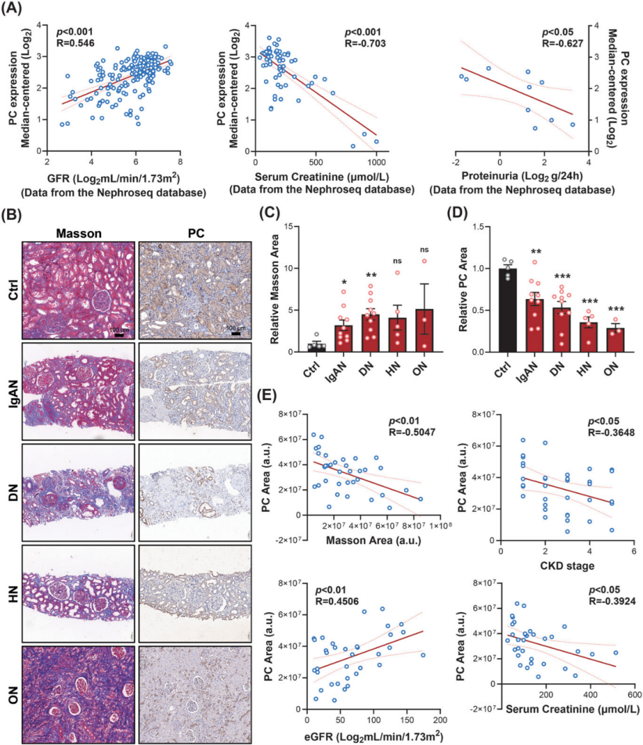 Adv Sci丨揭示PC缺失通过调节SQOR/cGAS/STING介导的糖酵解促进肾脏纤维化进展医药新闻-ByDrug-一站式医药资源共享中心-医药魔方