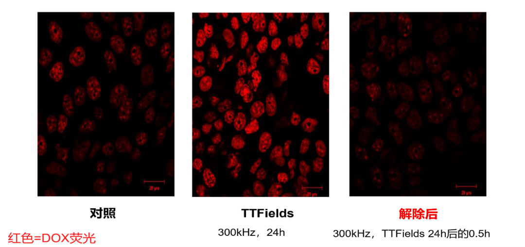 再放e彩丨2022 WFNOS&AACR：肿瘤治疗电场（TTFields）增高细胞膜通透性医药新闻-ByDrug-一站式医药资源共享中心-医药魔方