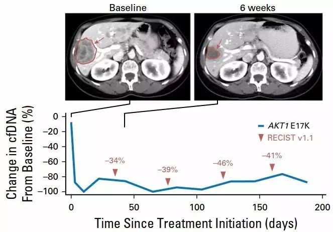 新靶点、新希望：泛AKT抑制剂在多种实体瘤中显出应用前景医药新闻-ByDrug-一站式医药资源共享中心-医药魔方