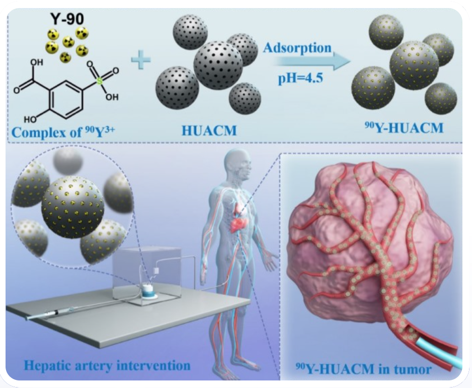 全球首例，癌王胰腺癌这次挨针扎了，钇[90Y]炭微球注射液是什么药？医药新闻-ByDrug-一站式医药资源共享中心-医药魔方