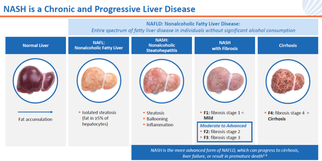 百亿市场终被撬动！NASH领域还有哪些玩家？医药新闻-ByDrug-一站式医药资源共享中心-医药魔方