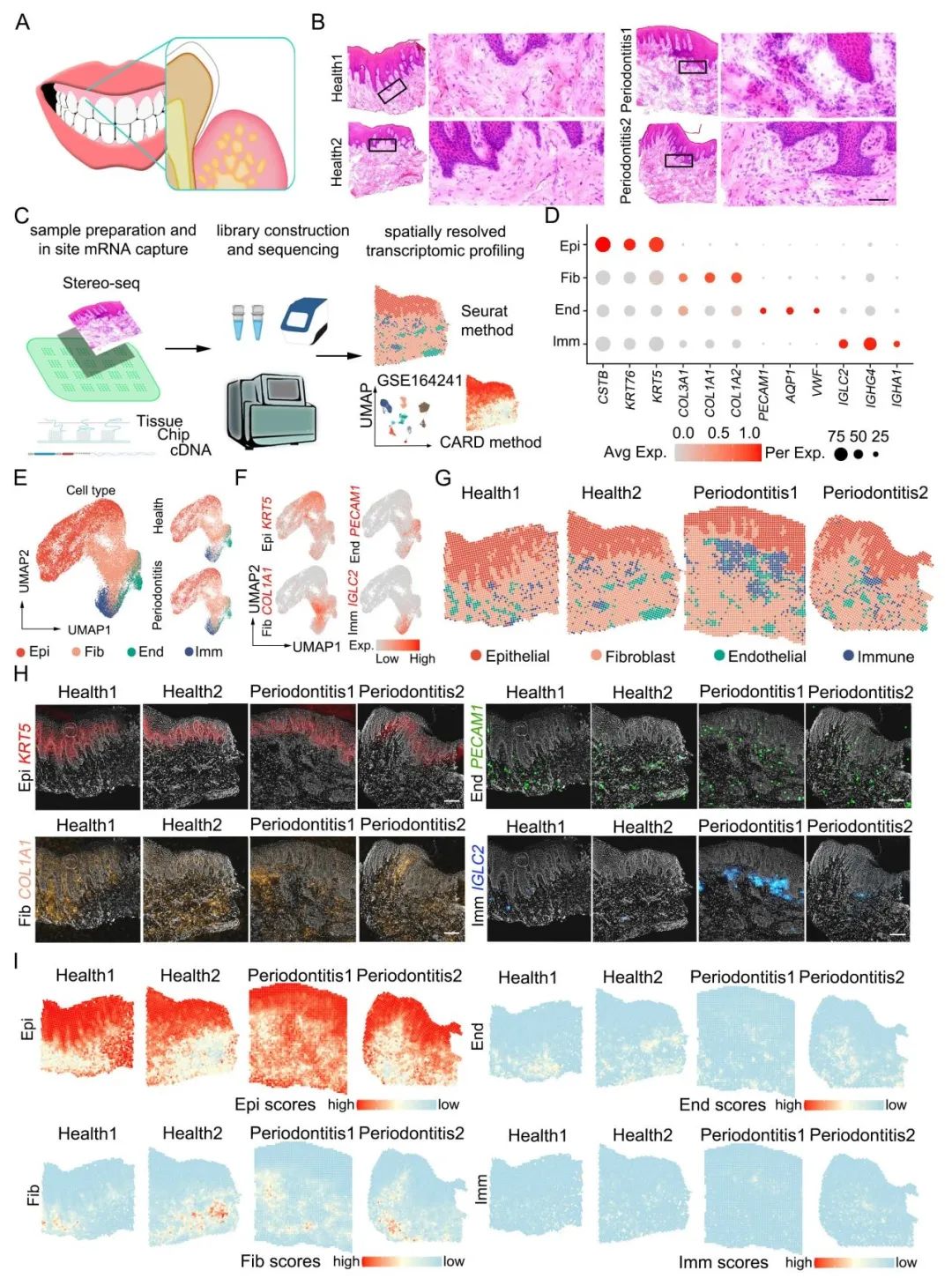 Sci China Life Sci | Stereo-seq与DNBSEQ助力中山大学等研究团队揭示牙周炎的免疫异常机制医药新闻-ByDrug-一站式医药资源共享中心-医药魔方