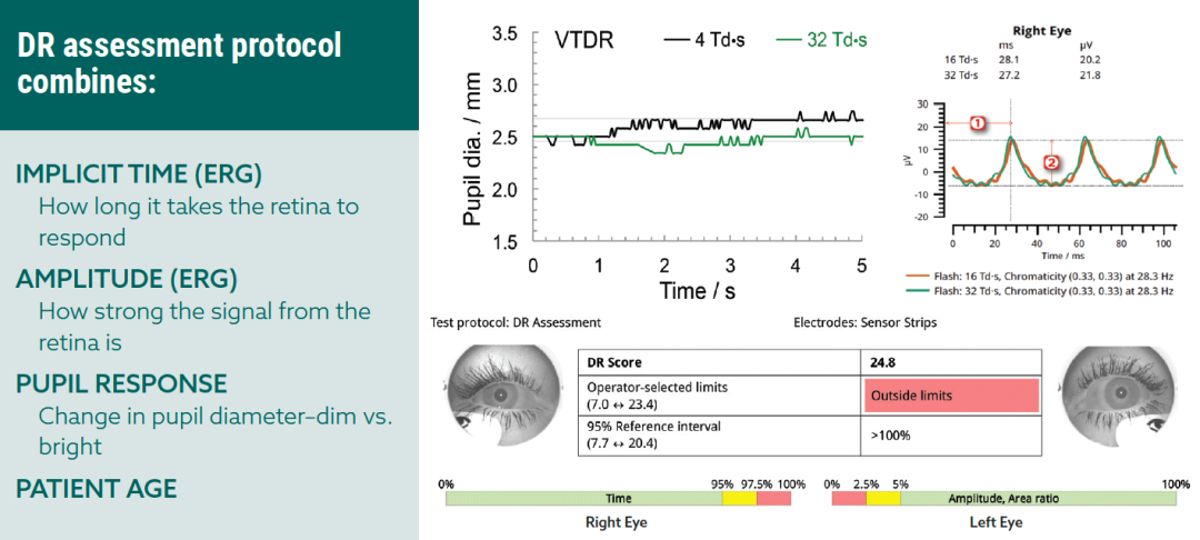 从结构到功能：ERG在DR中的临床应用医药新闻-ByDrug-一站式医药资源共享中心-医药魔方
