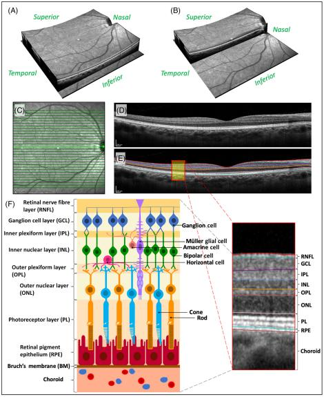 OCT扫描检测：肥胖症对视网膜完整性的早期潜在影响医药新闻-ByDrug-一站式医药资源共享中心-医药魔方