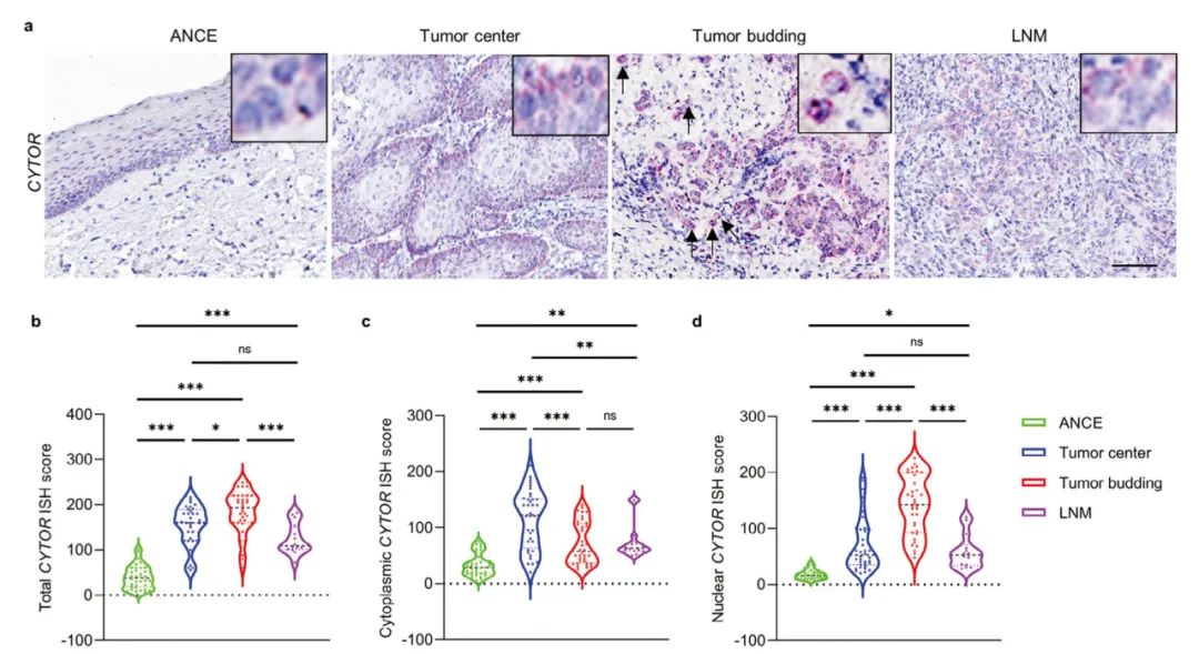 Adv Sci丨光华口腔医院团队揭示超级lncRNA CYTOR驱动HNSCC肿瘤出芽细胞转移的机制医药新闻-ByDrug-一站式医药资源共享 ...
