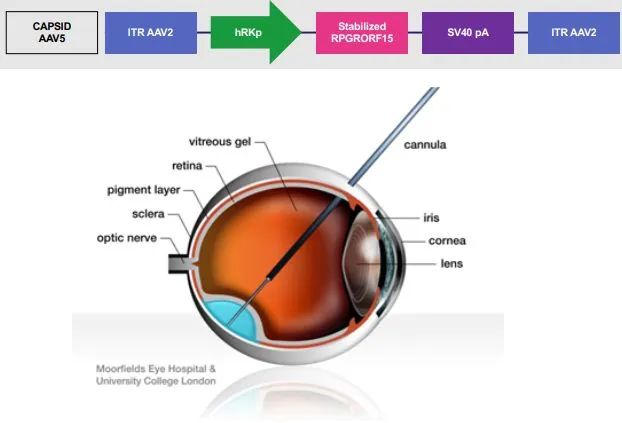 强生眼科基因疗法AAV5-hRKp.RPGR拟纳入突破性疗法医药新闻-ByDrug-一站式医药资源共享中心-医药魔方
