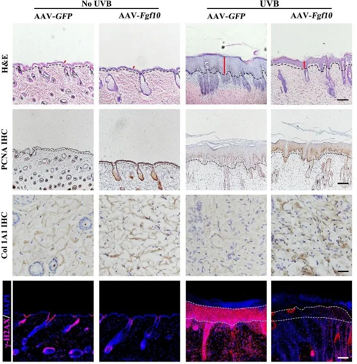 【on-target】AAV感染皮肤 | 血清型·启动子·注射用量 | 一篇就GO了！医药新闻-ByDrug-一站式医药资源共享中心-医药魔方