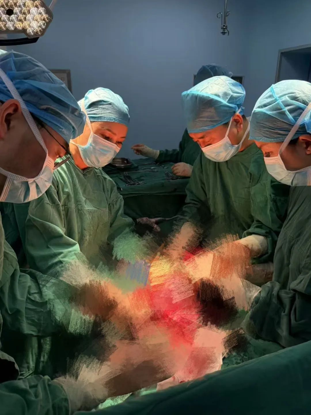 仁心仁术 | 护航生命！附属肿瘤医院多学科联合再创奇迹，腹盆腔高难度巨瘤被成功切除！医药新闻-ByDrug-一站式医药资源共享中心-医药魔方