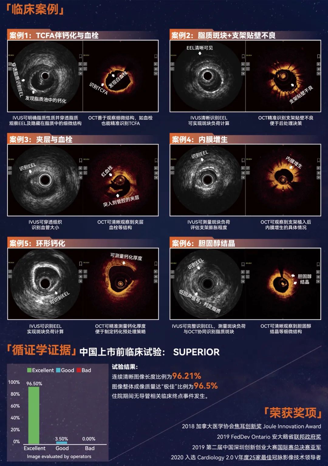 远大医药心脑血管精准介入诊疗板块三款重磅产品获批上市医药新闻-ByDrug-一站式医药资源共享中心-医药魔方
