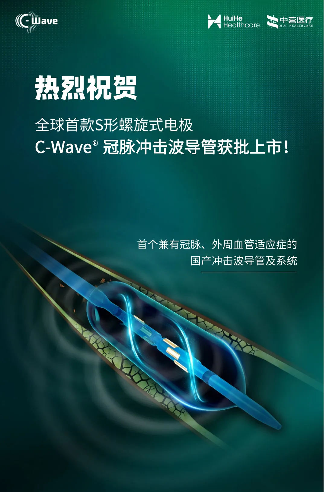 Sherpa Friends | 夏尔巴投资企业汇禾医疗C-Wave®冠脉冲击波导管获批上市医药新闻-ByDrug-一站式医药资源共享中心-医药魔方