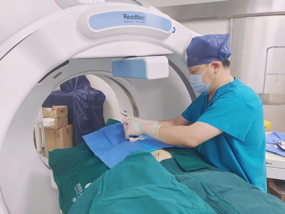 48家医院联合制定！《CT引导下经皮胃造瘘术专家共识》规范技术造福患者医药新闻-ByDrug-一站式医药资源共享中心-医药魔方