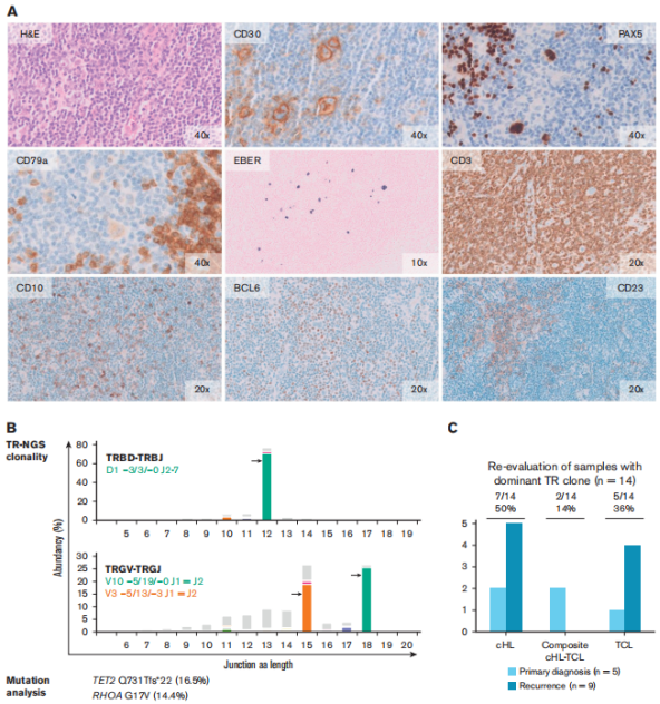 基于IG/TCR NGS检测揭示经典霍奇金淋巴瘤复发的奥秘，可能会改变临床治疗策略！医药新闻-ByDrug-一站式医药资源共享中心-医药魔方