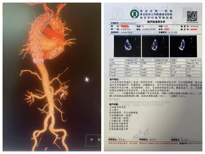 RDN来了！高血压治疗新技术医药新闻-ByDrug-一站式医药资源共享中心-医药魔方