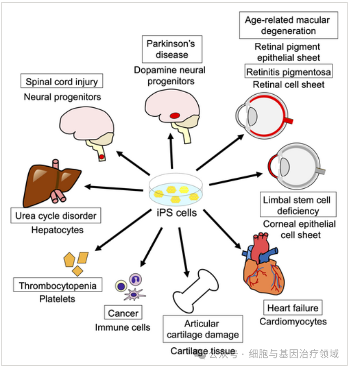 全球首例借助物理屏障技术规避免疫排斥的异体iPS细胞治疗糖尿病临床试验结果发布医药新闻-ByDrug-一站式医药资源共享中心-医药魔方