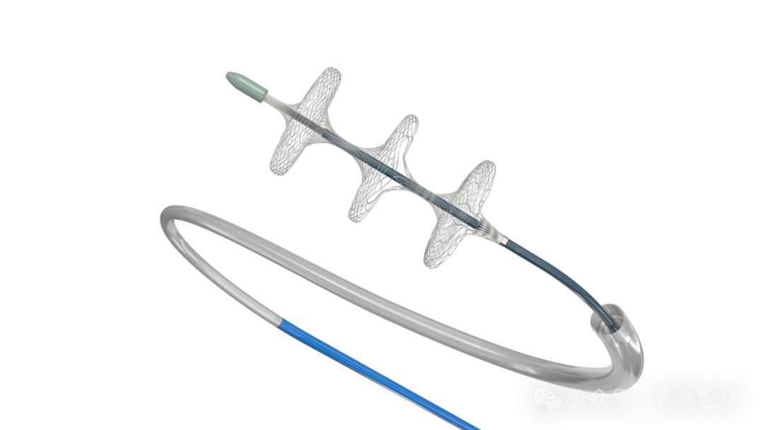 【同创Family】国内首创！「腾复医疗」Tendvia®肺动脉取栓支架系统获得国家药品监督管理局批准上市医药新闻-ByDrug-一站式医药 ...