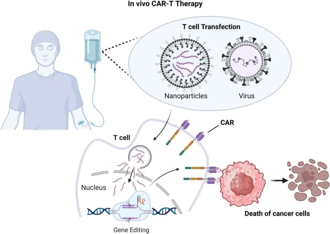 体内制造CAR-T细胞疗法的前沿进展和挑战医药新闻-ByDrug-一站式医药资源共享中心-医药魔方