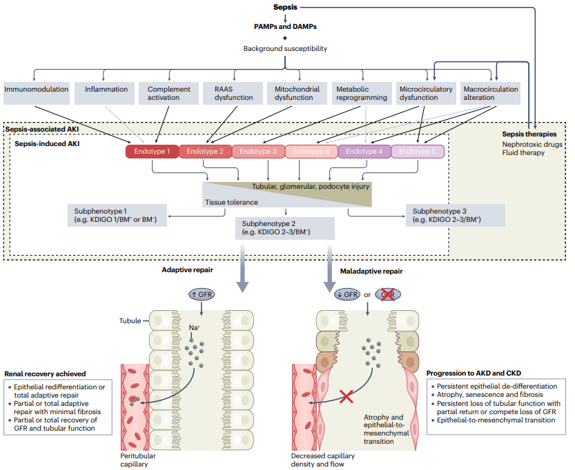 ADQI 2023： 脓毒症相关急性肾损伤共识医药新闻-ByDrug-一站式医药资源共享中心-医药魔方
