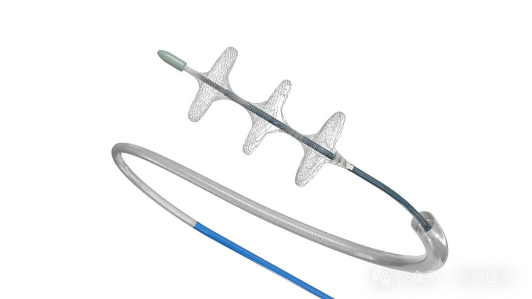 首批临床！国产首款肺动脉取栓支架系统医药新闻-ByDrug-一站式医药资源共享中心-医药魔方