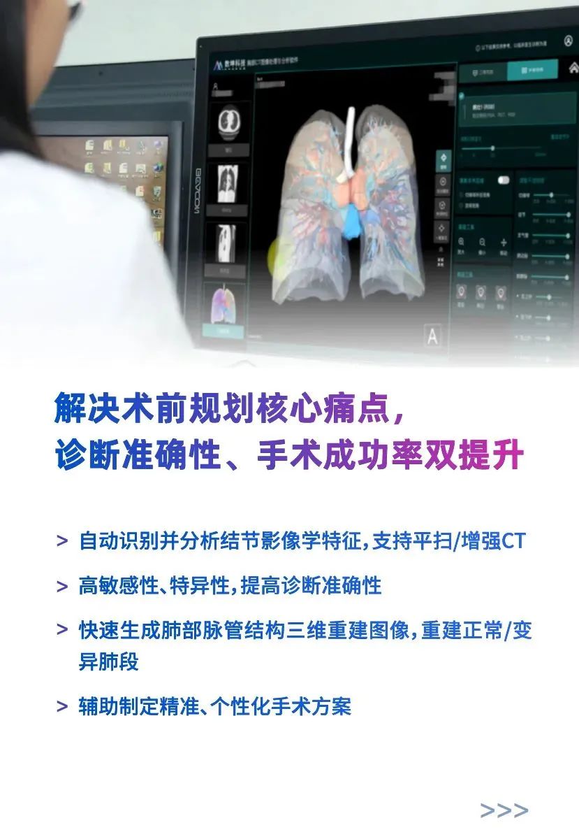 企业资讯丨胸外科手术利器！数坤科技AI肺部术前规划产品获NMPA三类证医药新闻-ByDrug-一站式医药资源共享中心-医药魔方