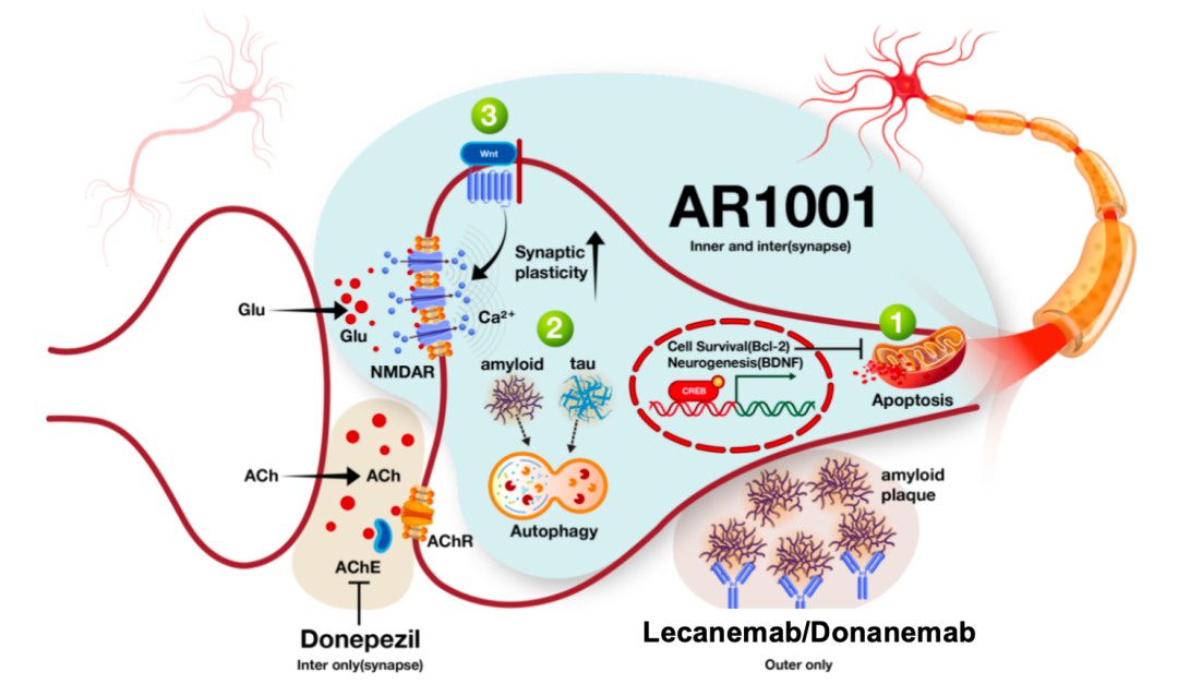 重大里程碑！AR1001治疗阿尔茨海默病国际多中心III期临床研究在中国完成首例患者入组医药新闻-ByDrug-一站式医药资源共享中心-医药魔方