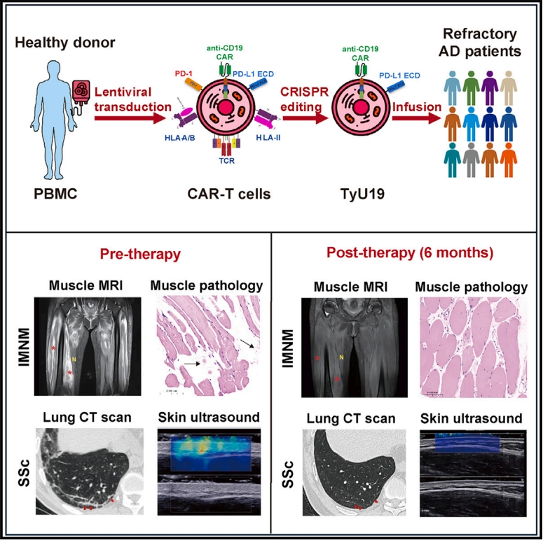 Cell全球首发！邦耀生物开发新一代异体通用型CAR-T治疗自免疾病获得重大突破医药新闻-ByDrug-一站式医药资源共享中心-医药魔方