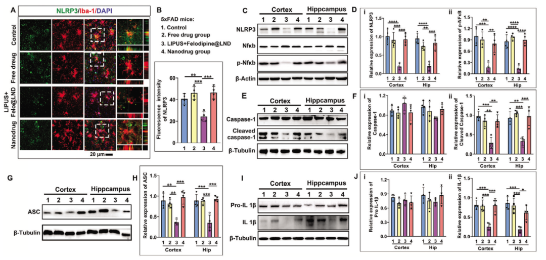 项目文章Adv Sci (IF14.3) | 脂质体纳米药物Felodipine@LND可改善AD医药新闻-ByDrug-一站式医药资源共享中心-医药魔方