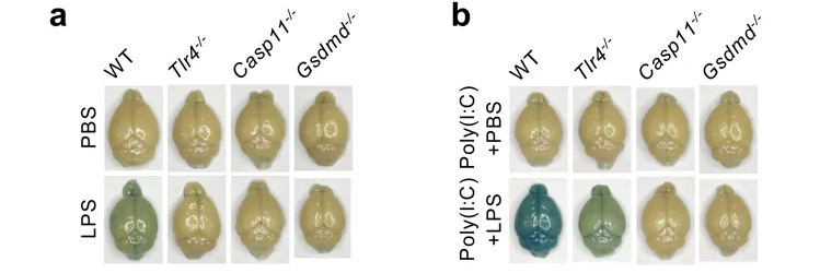 Nature！罗敏敏团队与邵峰团队合作揭示GSDMD的激活是炎症性血脑屏障破坏的关键机制医药新闻-ByDrug-一站式医药资源共享中心-医药魔方