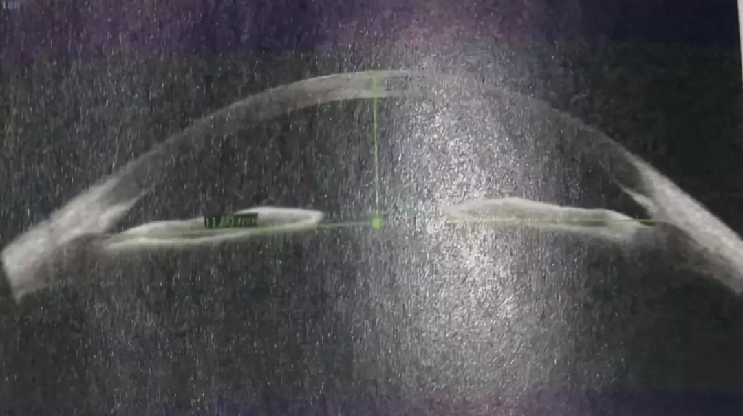 角膜解剖和OCT检查医药新闻-ByDrug-一站式医药资源共享中心-医药魔方